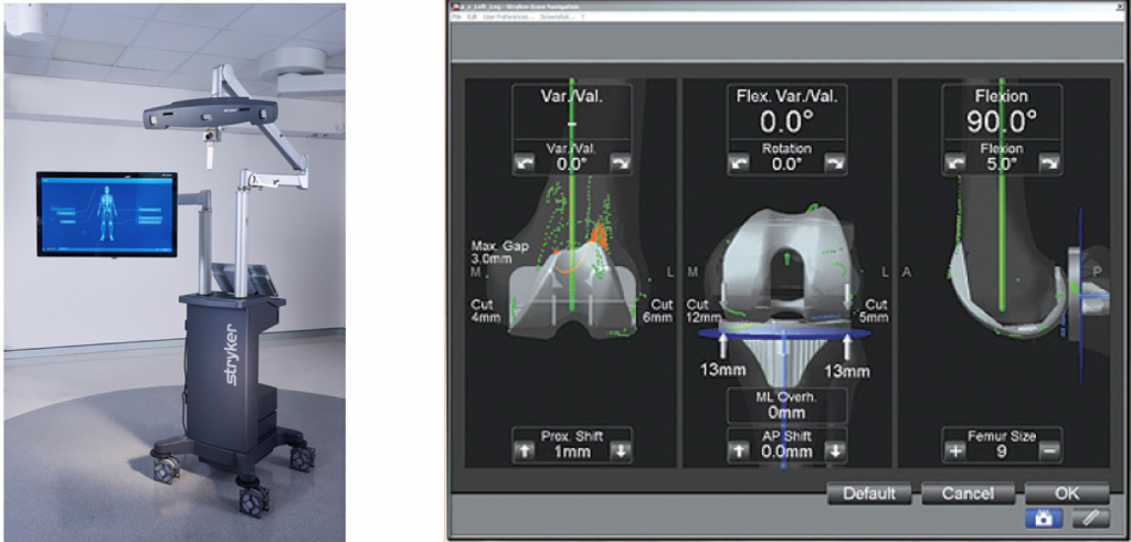 Total Knee Replacement Surgery by Dr David Slattery