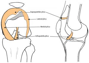 Plica Knee Condition | David Slattery