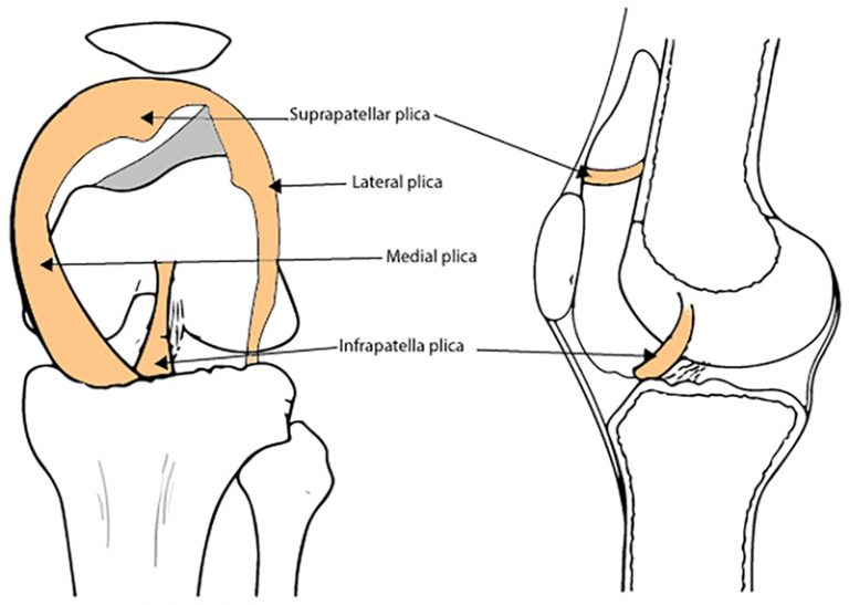 Plica Knee Condition | David Slattery